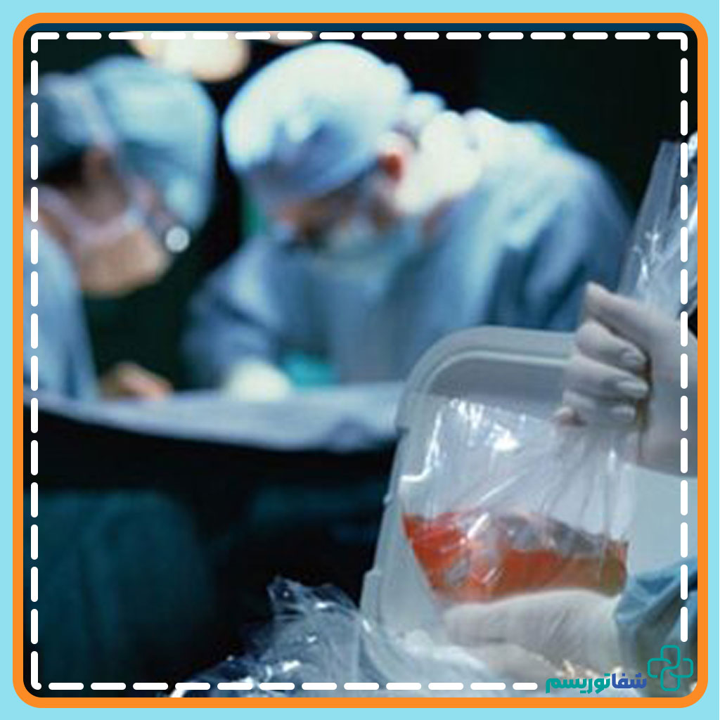 Organ transplant in Iran | Shafa Tourism Company